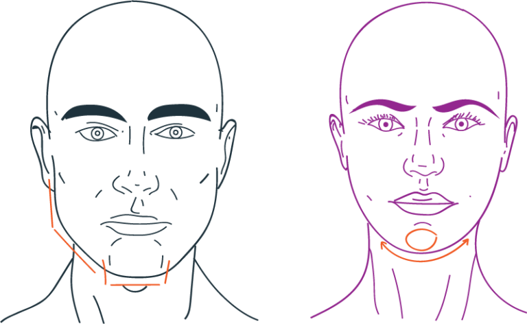 Chin reduction or recontouring in feminization - Facifem FFS experts