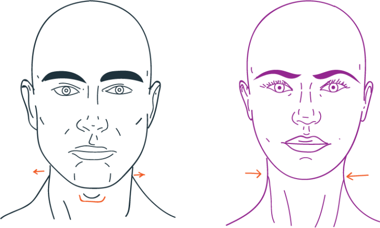 Tracheal shave or Adam apple reduction at Facifem
